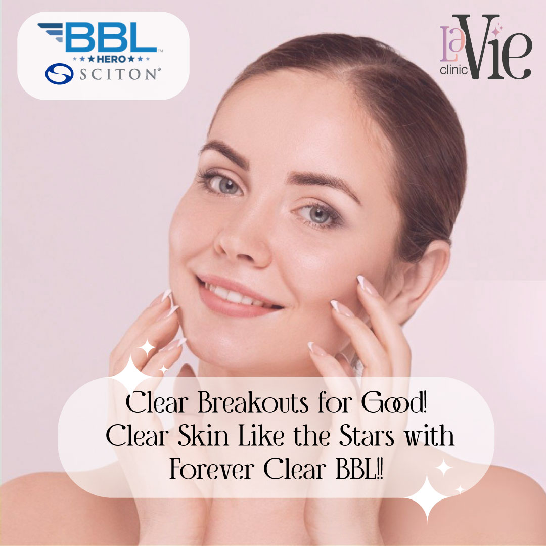 Forever Clear BBL Acne-free treatment - La Vie Med Spa