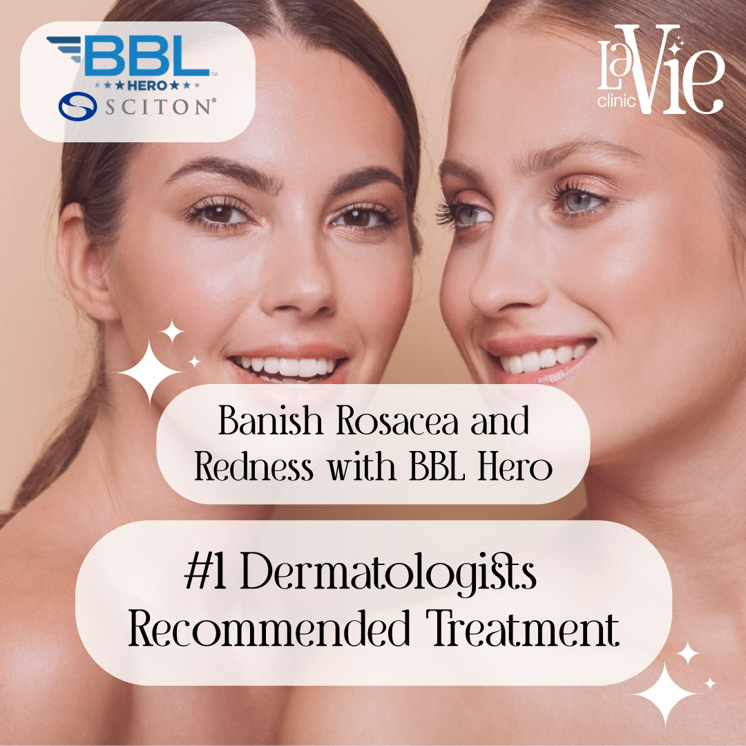 BBL For Rosacea - La Vie Med Spa