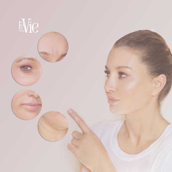 EZ Gel PRF Natural Plasma Filler - La Vie Med Spa