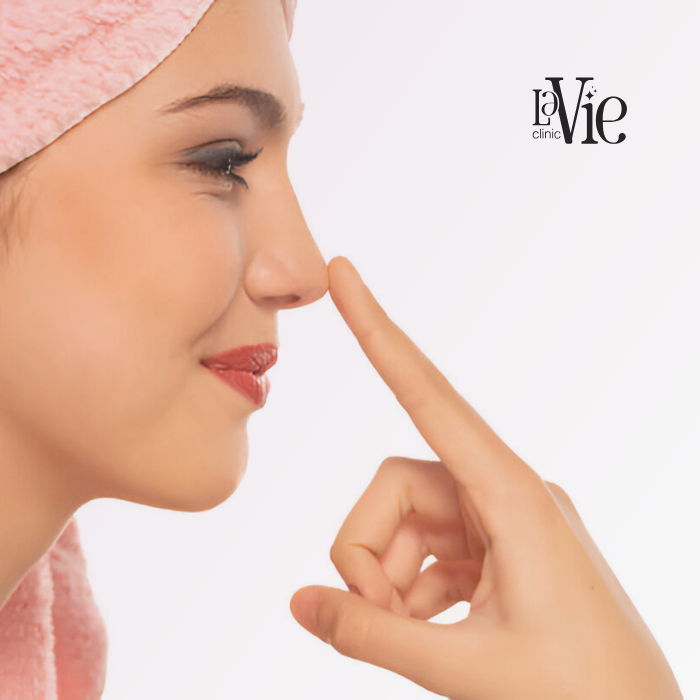 Non-Surgical Nose Job - La Vie Med Spa